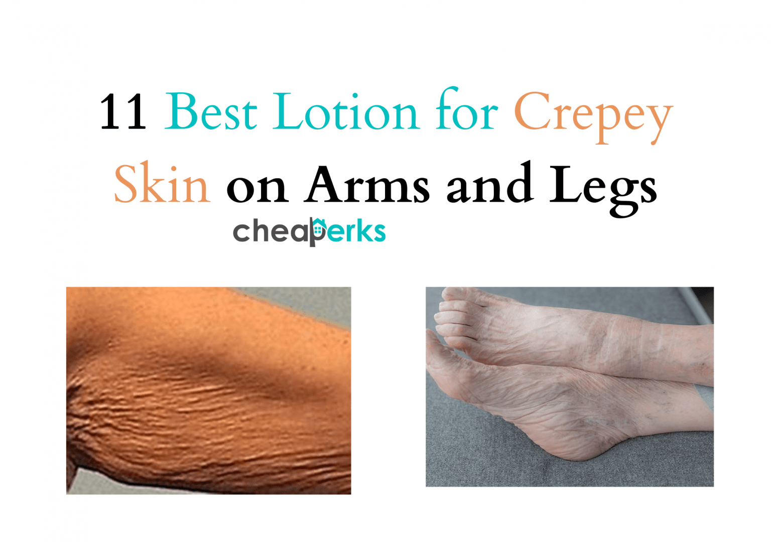 11 Best Lotion For Crepey Skin On Arms And Legs 2020 Guide Cheaperks