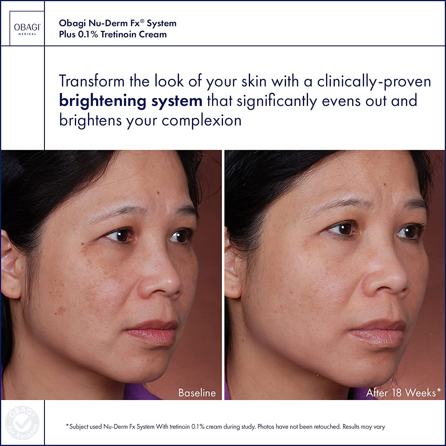 Obagi Nu-Derm System Review - A Detailed Analysis - Cheaperks